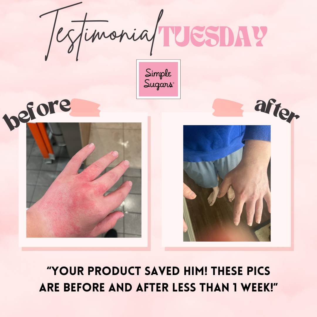 "Your product SAVED HIM! These pics are before and after less than 1 w ...
